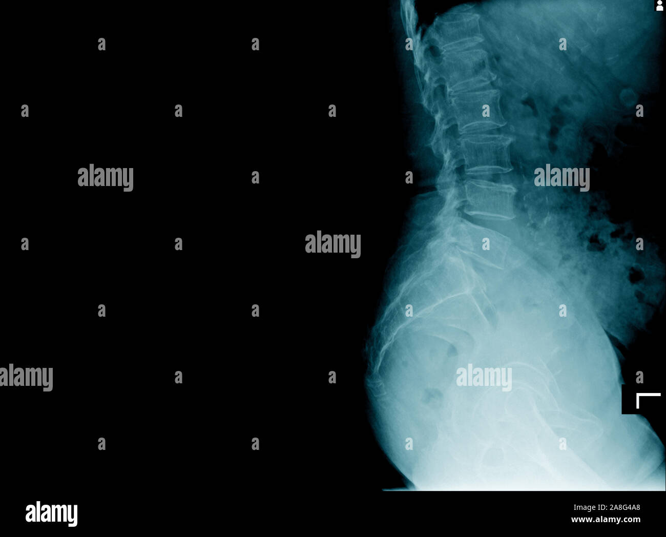 Human anatomy back view hi-res stock photography and images - Alamy