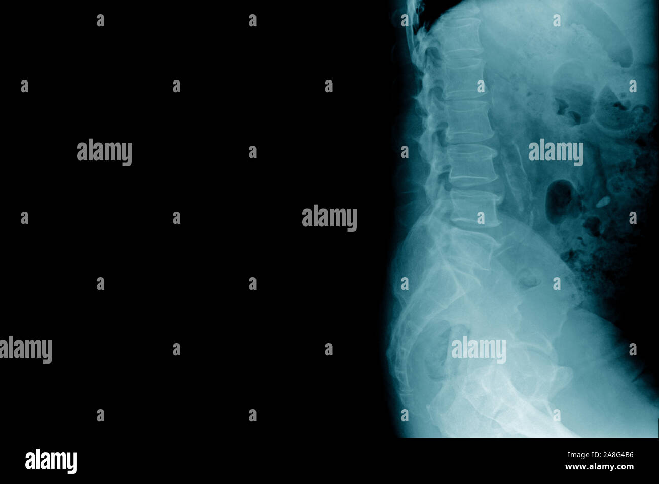 Spine lateral view hi-res stock photography and images - Alamy
