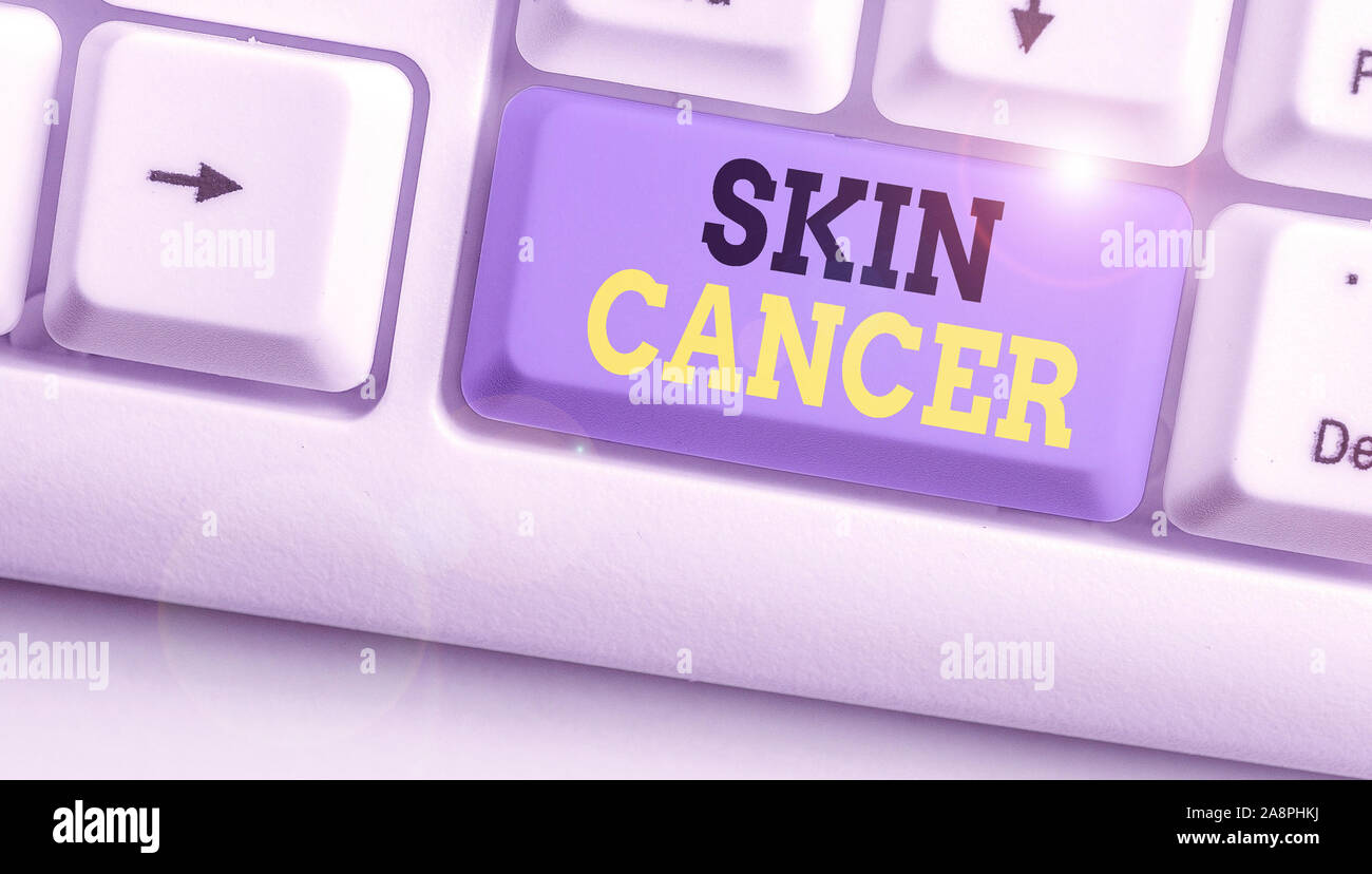 Handwriting text writing Skin Cancer. Conceptual photo uncontrolled ...