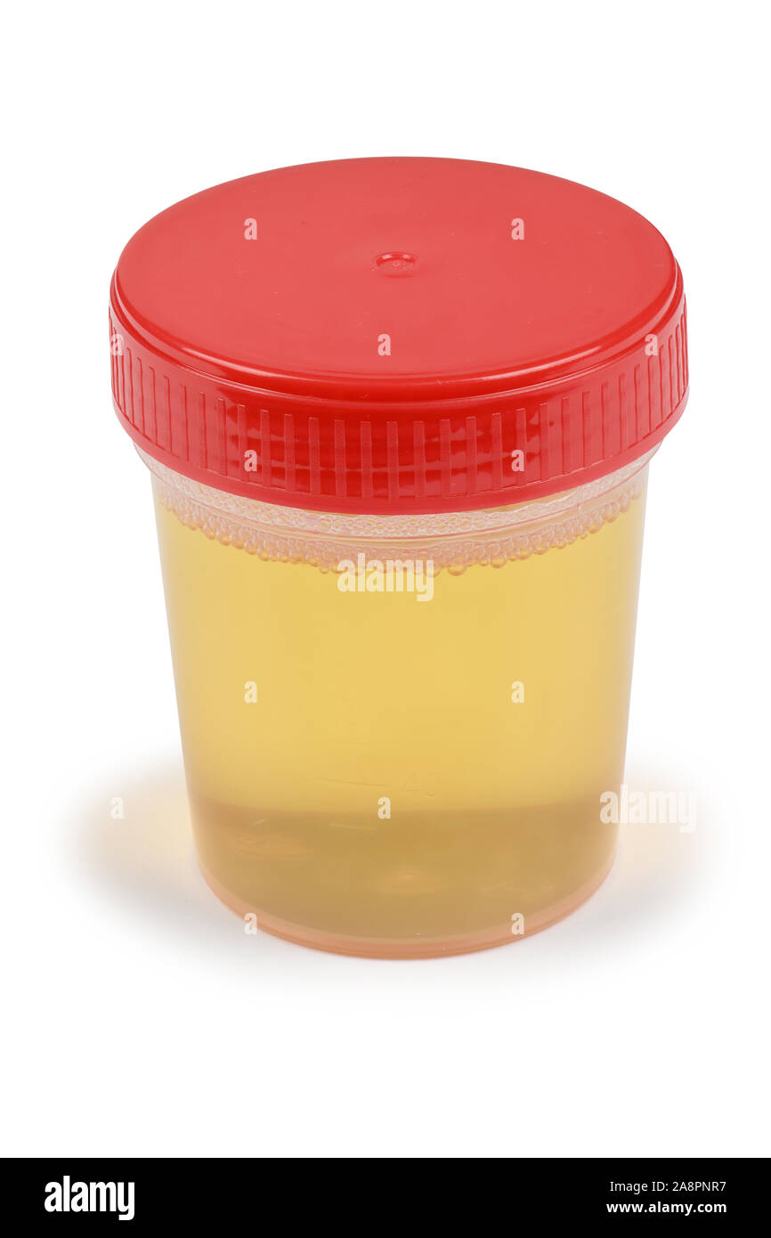 Urine sample in container. High resolution photo. With clipping path ...