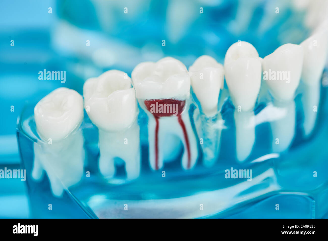 selective focus of teeth model with white teeth and red dental root ...