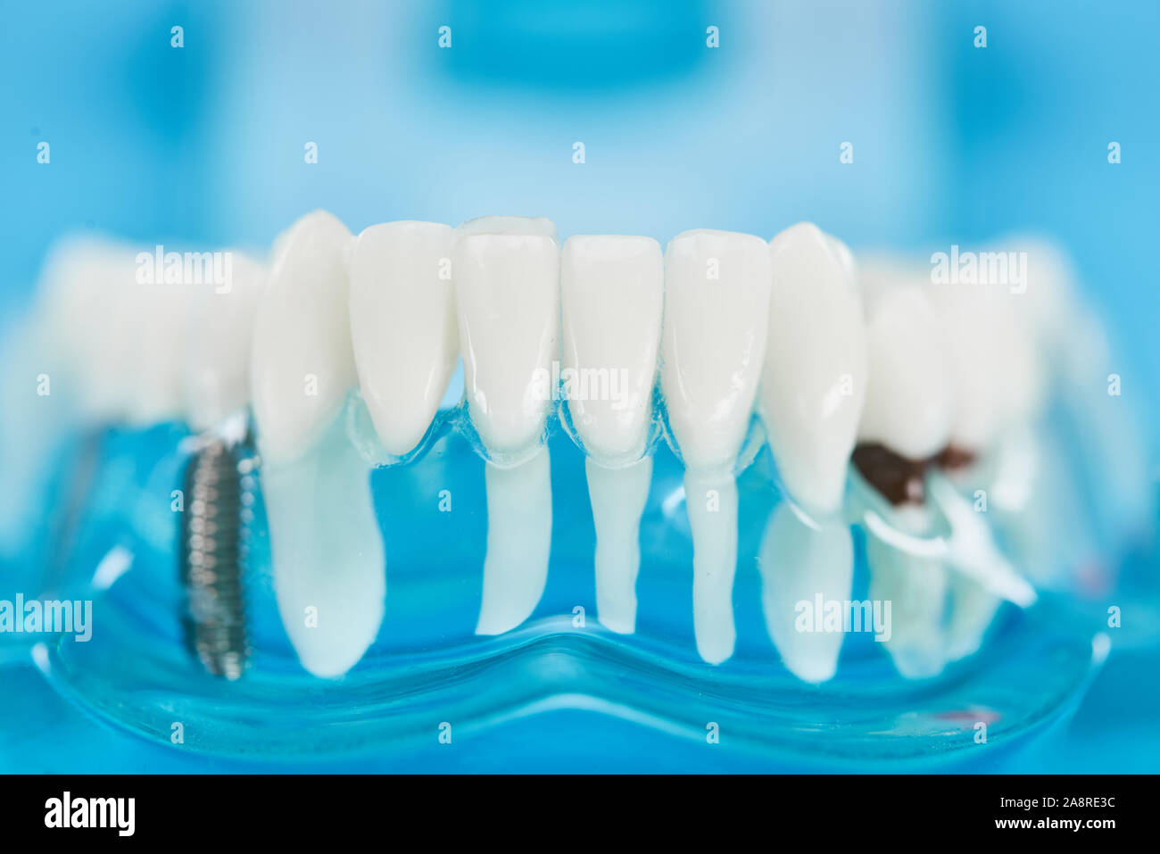 Teeth roots hi-res stock photography and images - Alamy