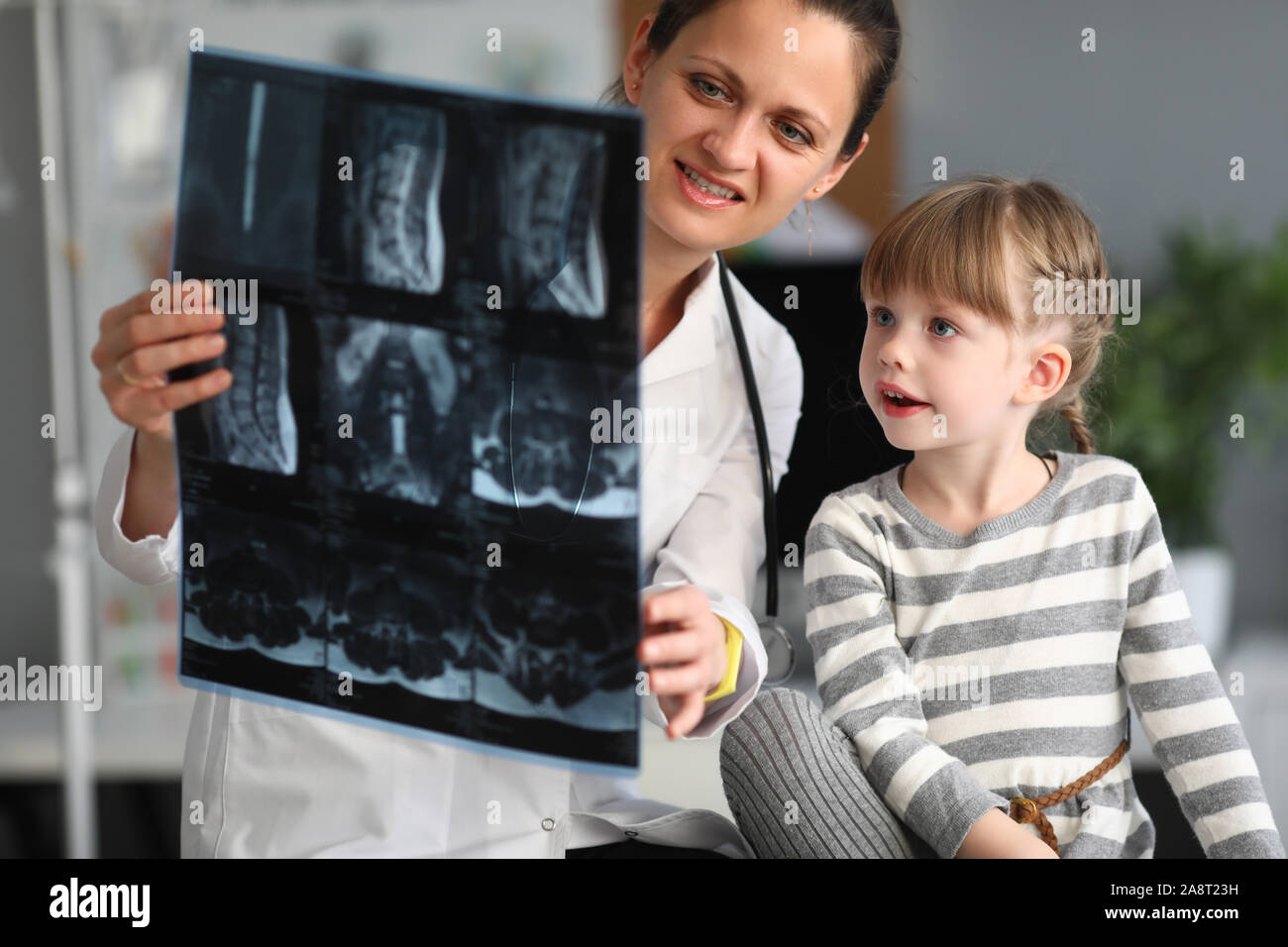 X-ray of child spine Stock Photo - Alamy