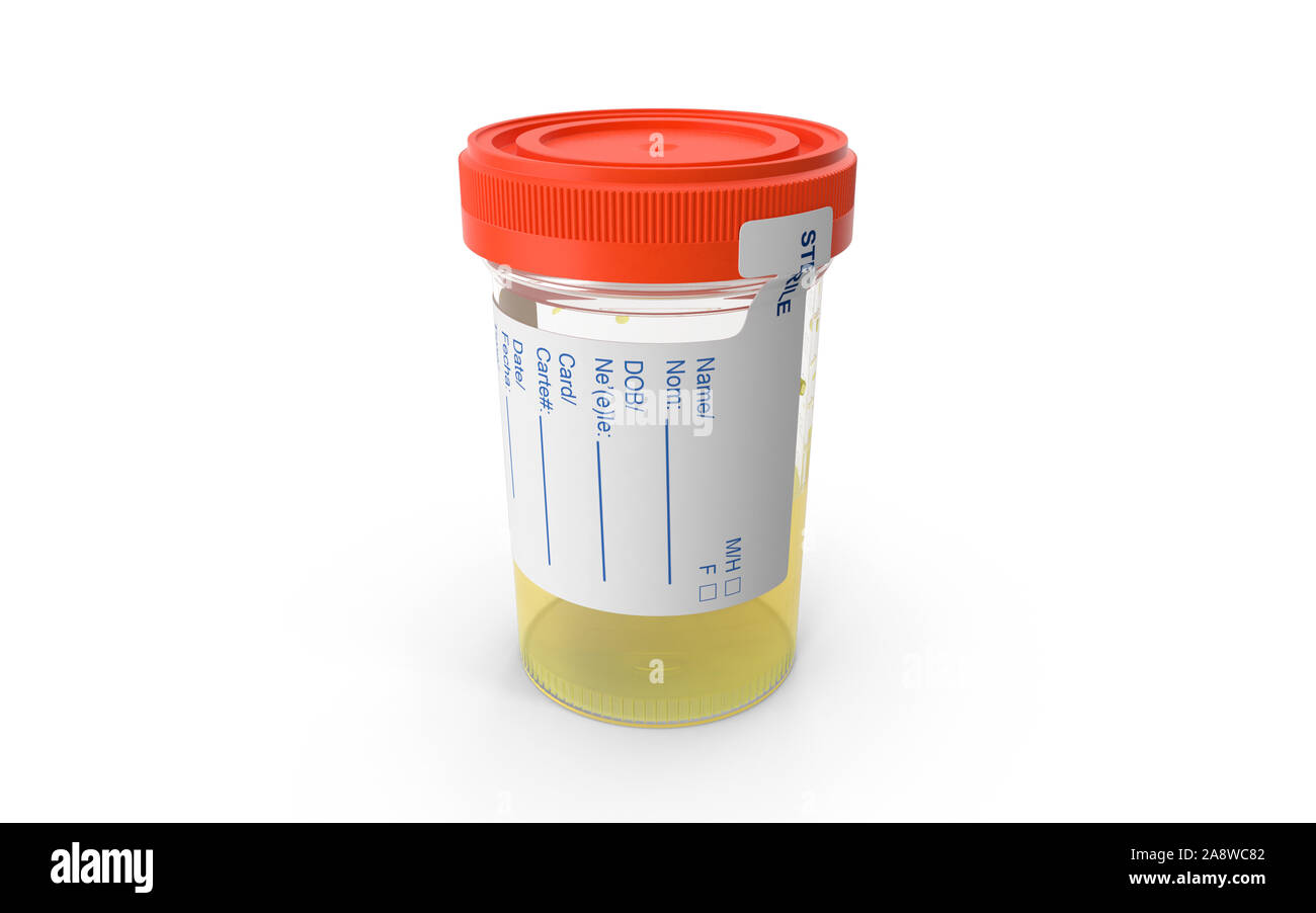 3D Urine Sample Bottle against white background with real drop shadow ...