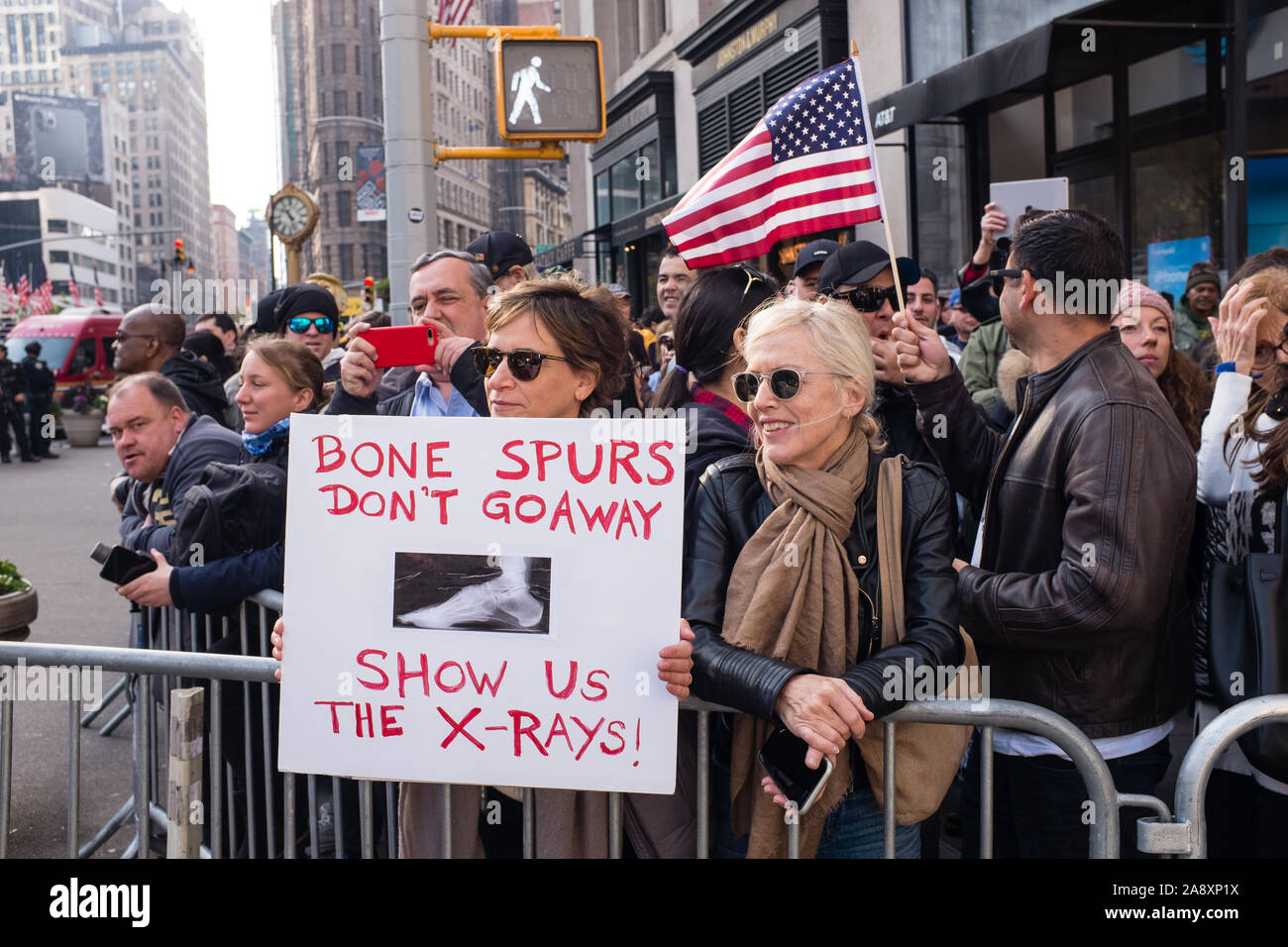Bone spurs hi-res stock photography and images - Alamy