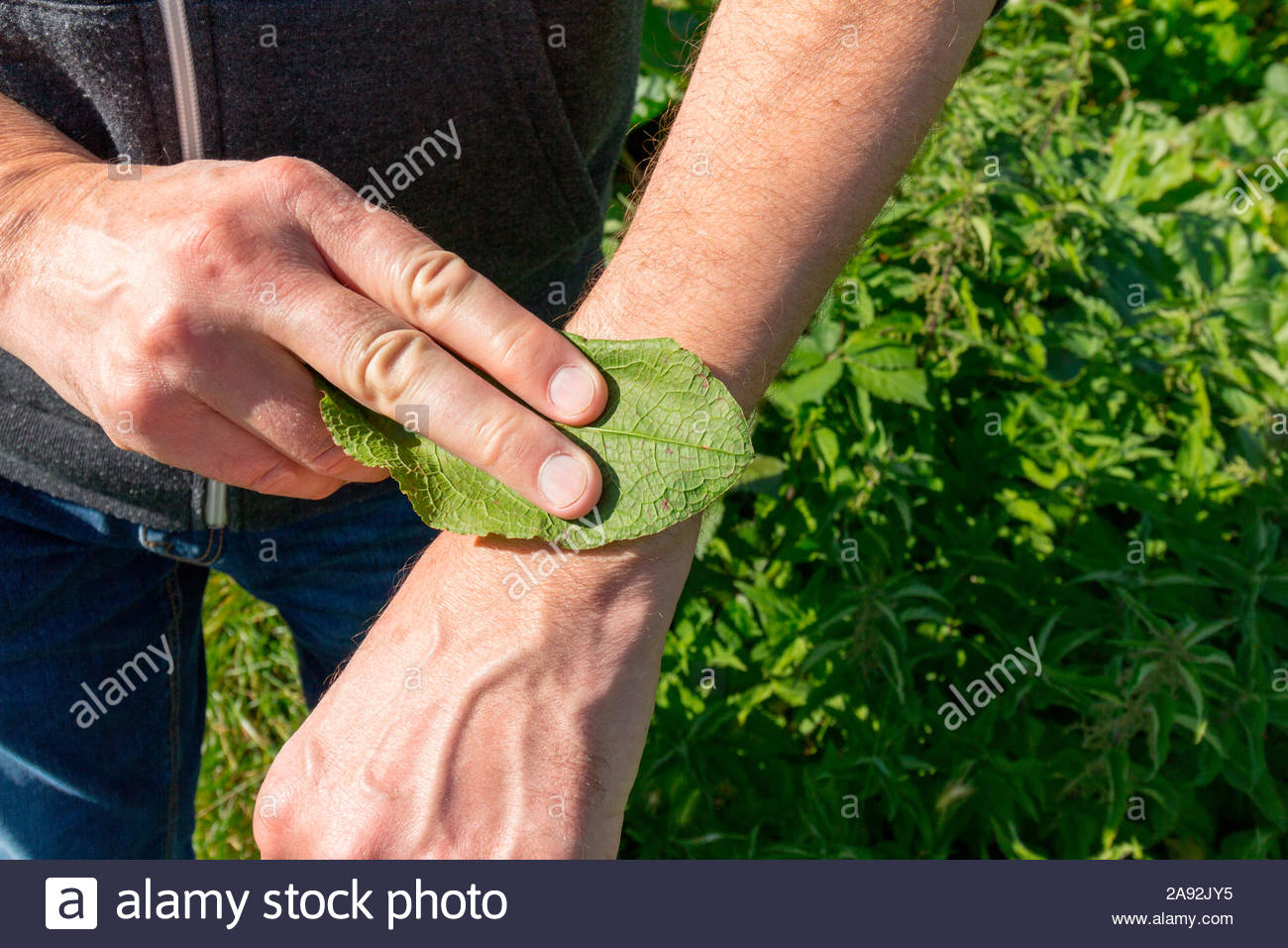 Nettle Rash High Resolution Stock Photography and Images - Alamy