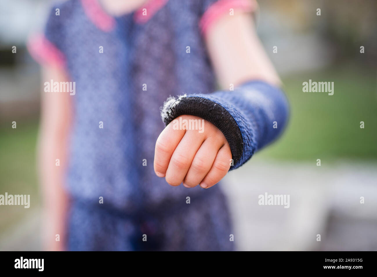 Arm in plaster hi-res stock photography and images - Alamy