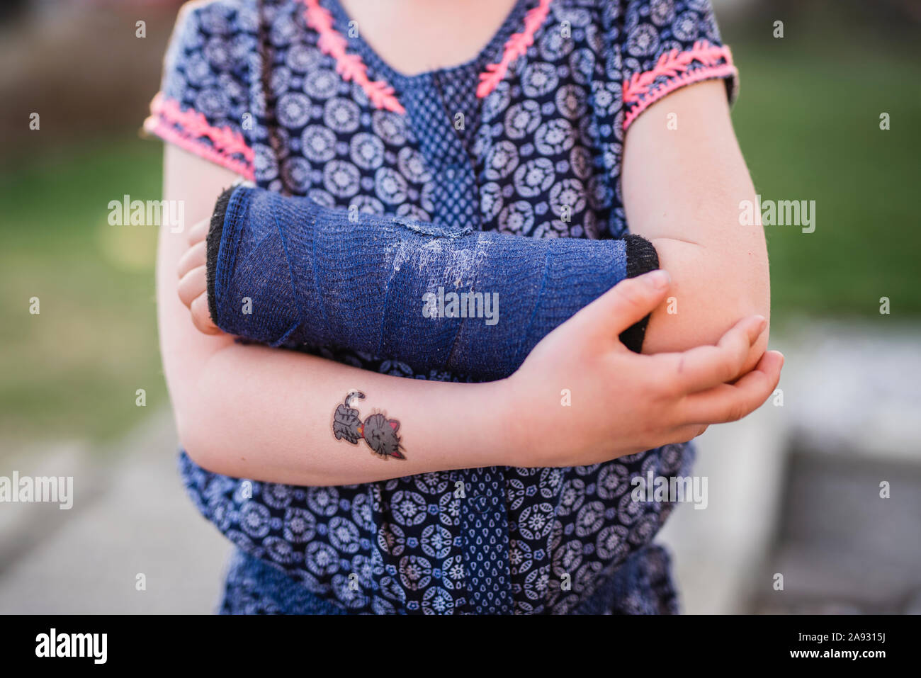 Girl with plastered arm Stock Photo - Alamy