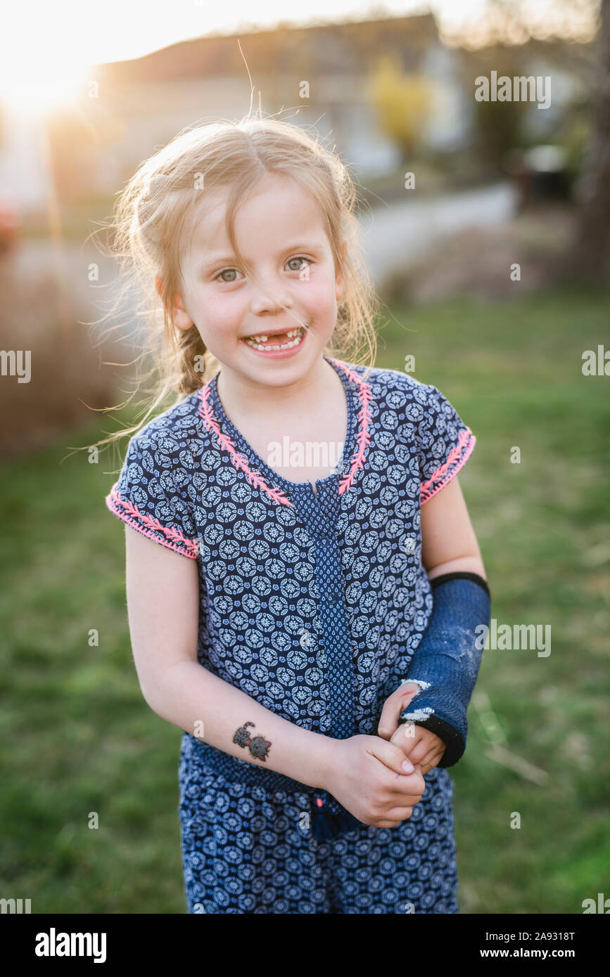 Girl with plastered arm Stock Photo - Alamy