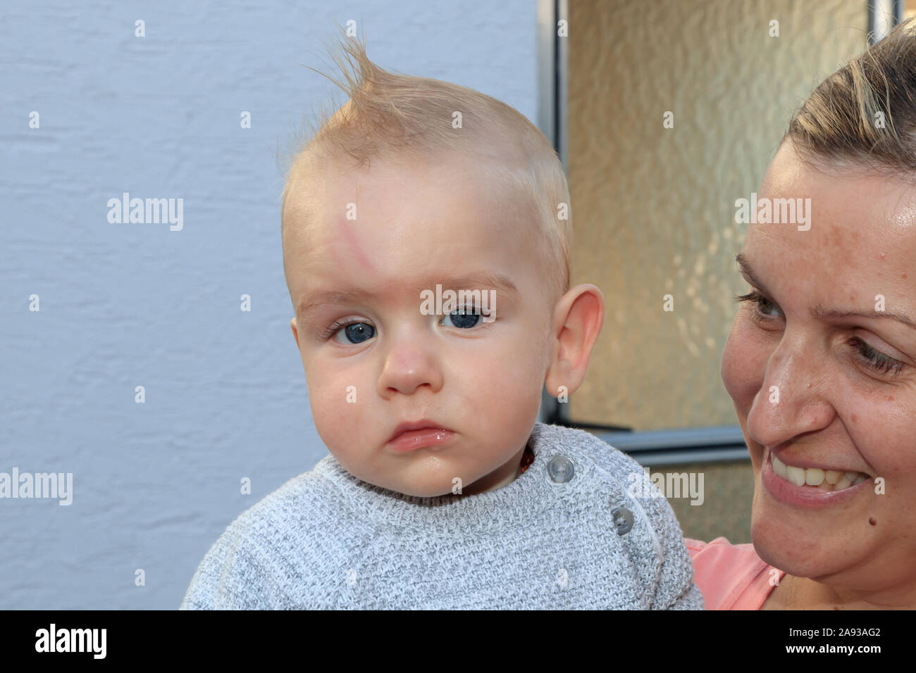 Forehead scar hi-res stock photography and images - Alamy