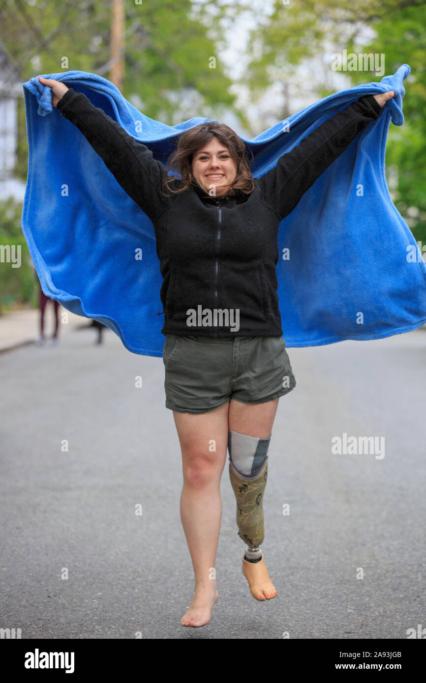 Girl with Presthitic leg in a parade Stock Photo - Alamy