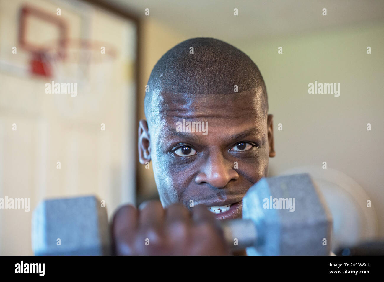 Williams syndrome disability hi-res stock photography and images - Alamy