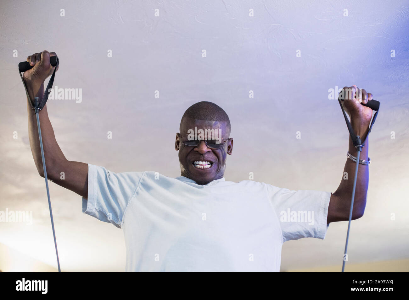 Williams syndrome hi-res stock photography and images - Alamy