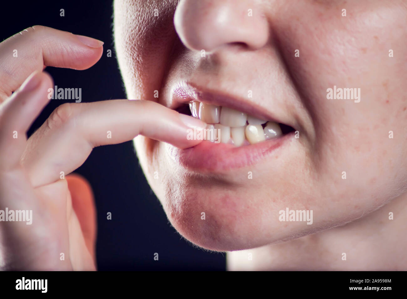 Woman nibbles nails when feels stress or nervous. People, bad habits ...