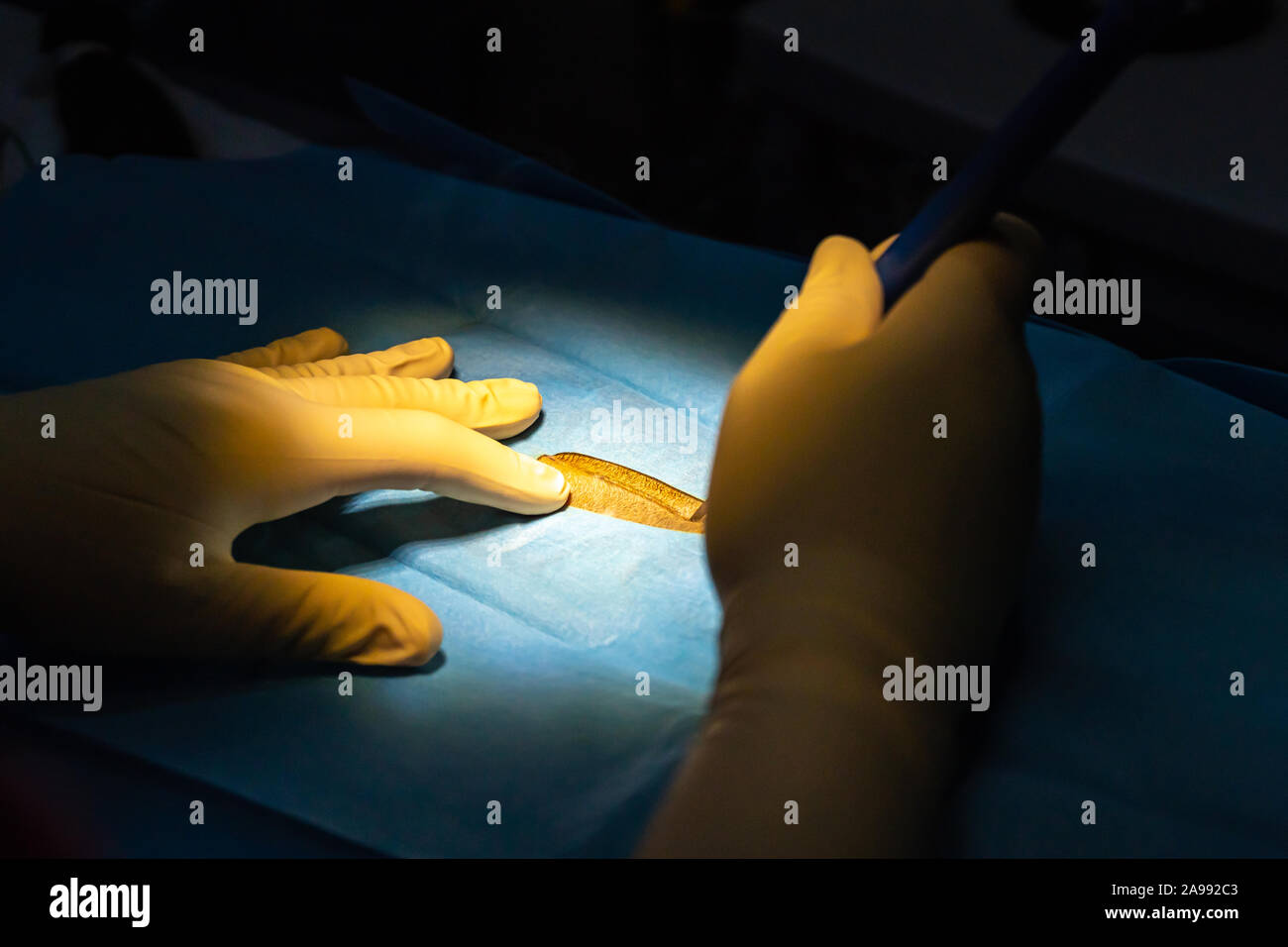 Surgeon Incision High Resolution Stock Photography and Images - Alamy