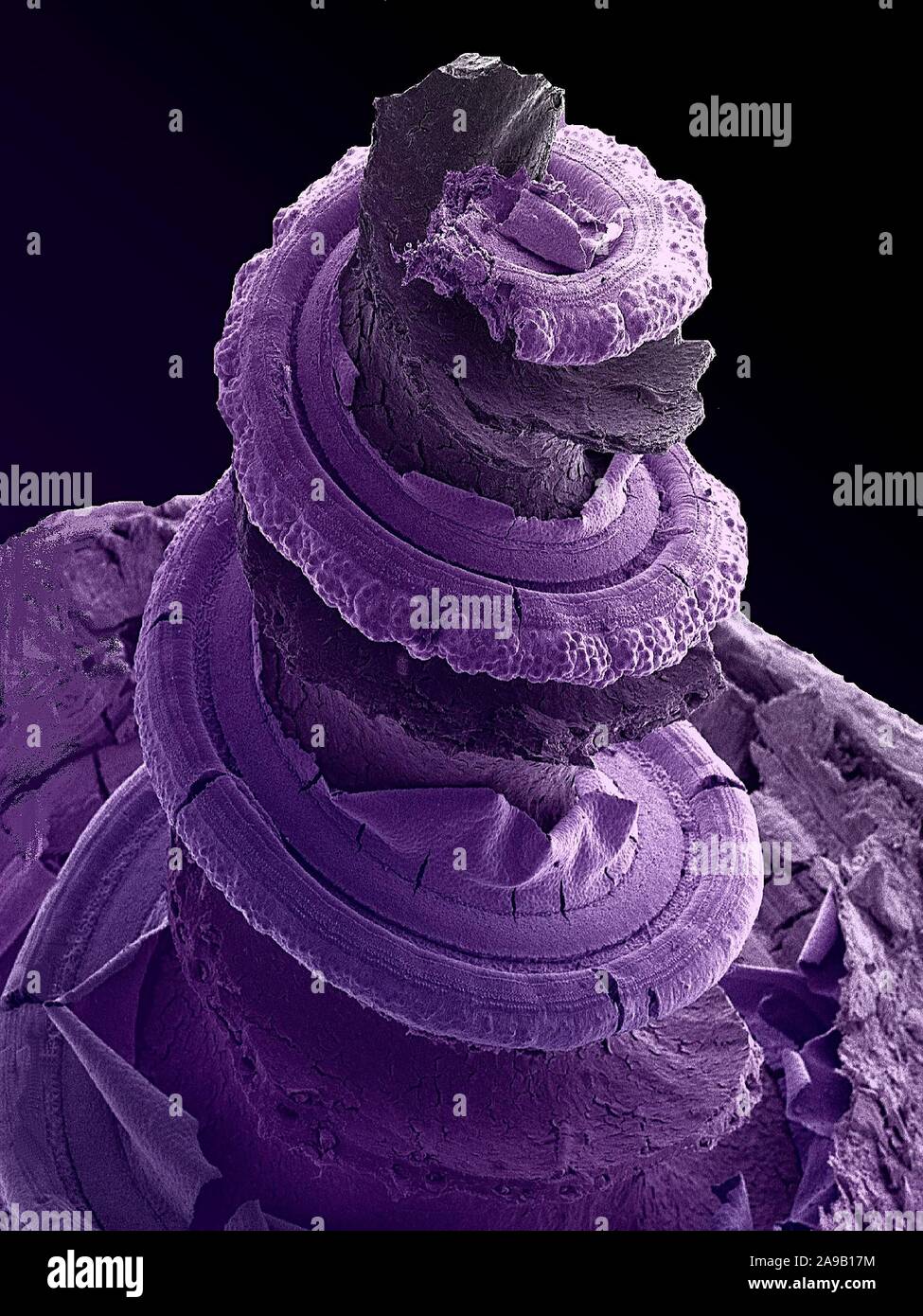 Eustachian tube ear hi-res stock photography and images - Alamy