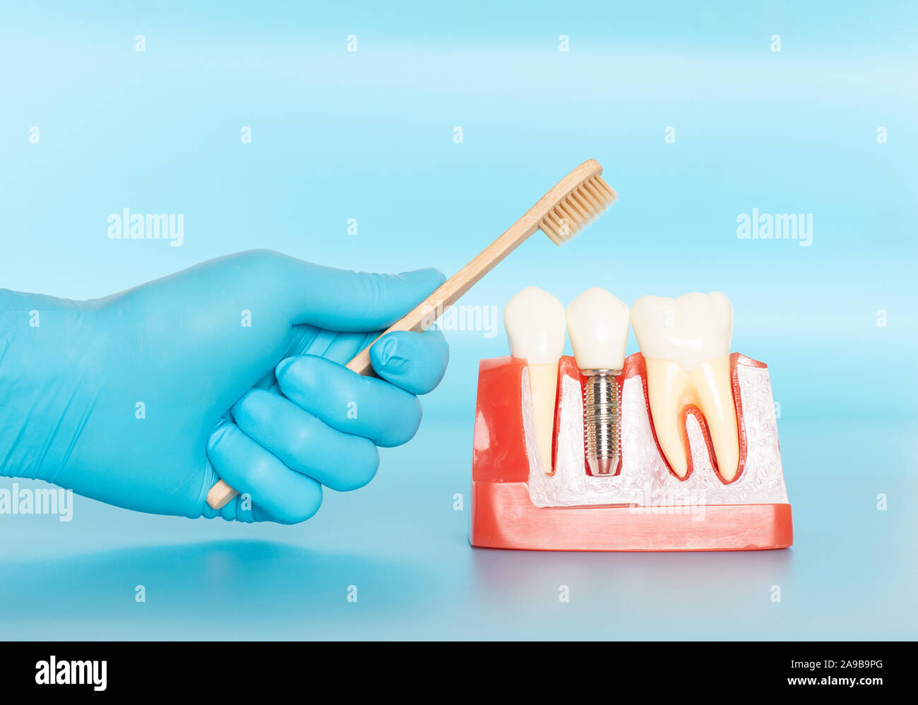 Plastic samples of dental implants compare with natural teeth for ...