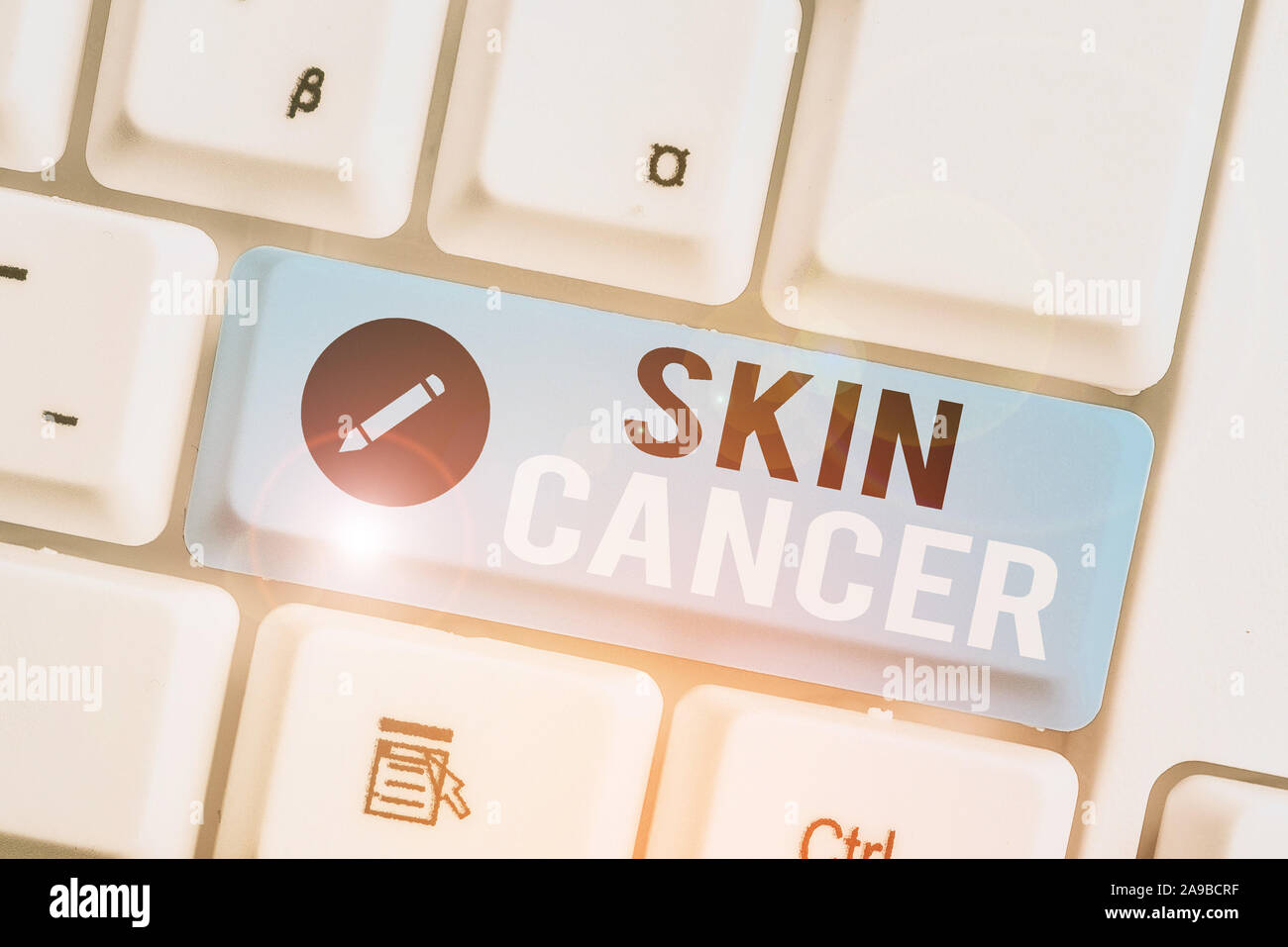 Handwriting text Skin Cancer. Conceptual photo uncontrolled growth of ...