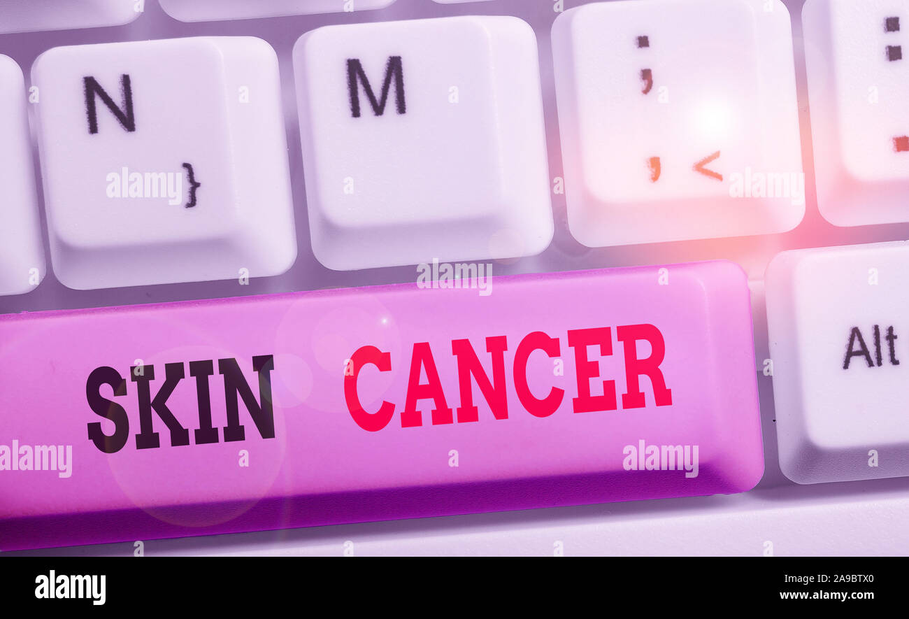 Writing note showing Skin Cancer. Business concept for uncontrolled ...