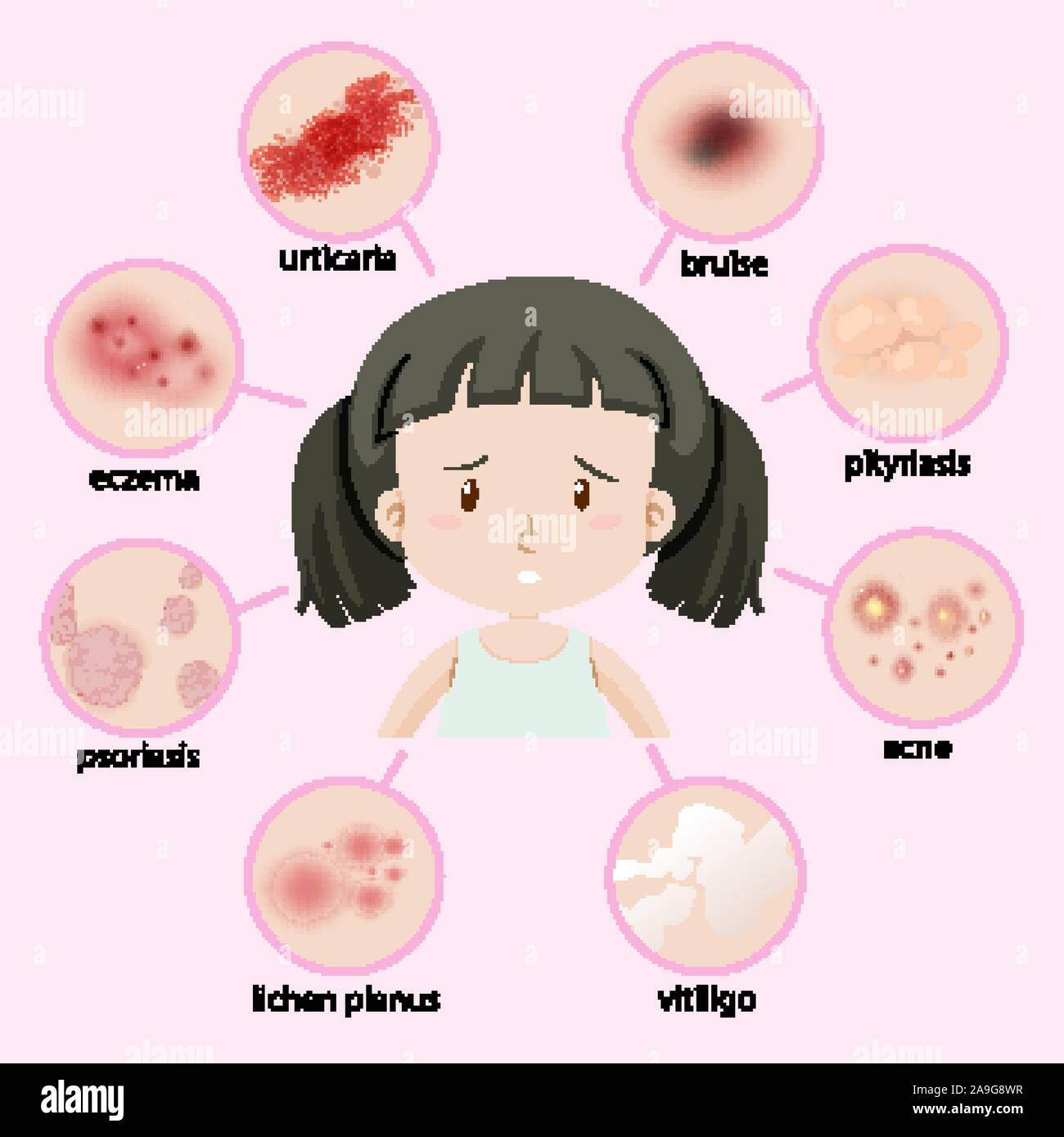 Diagram showing different types of disease in kid illustration Stock ...