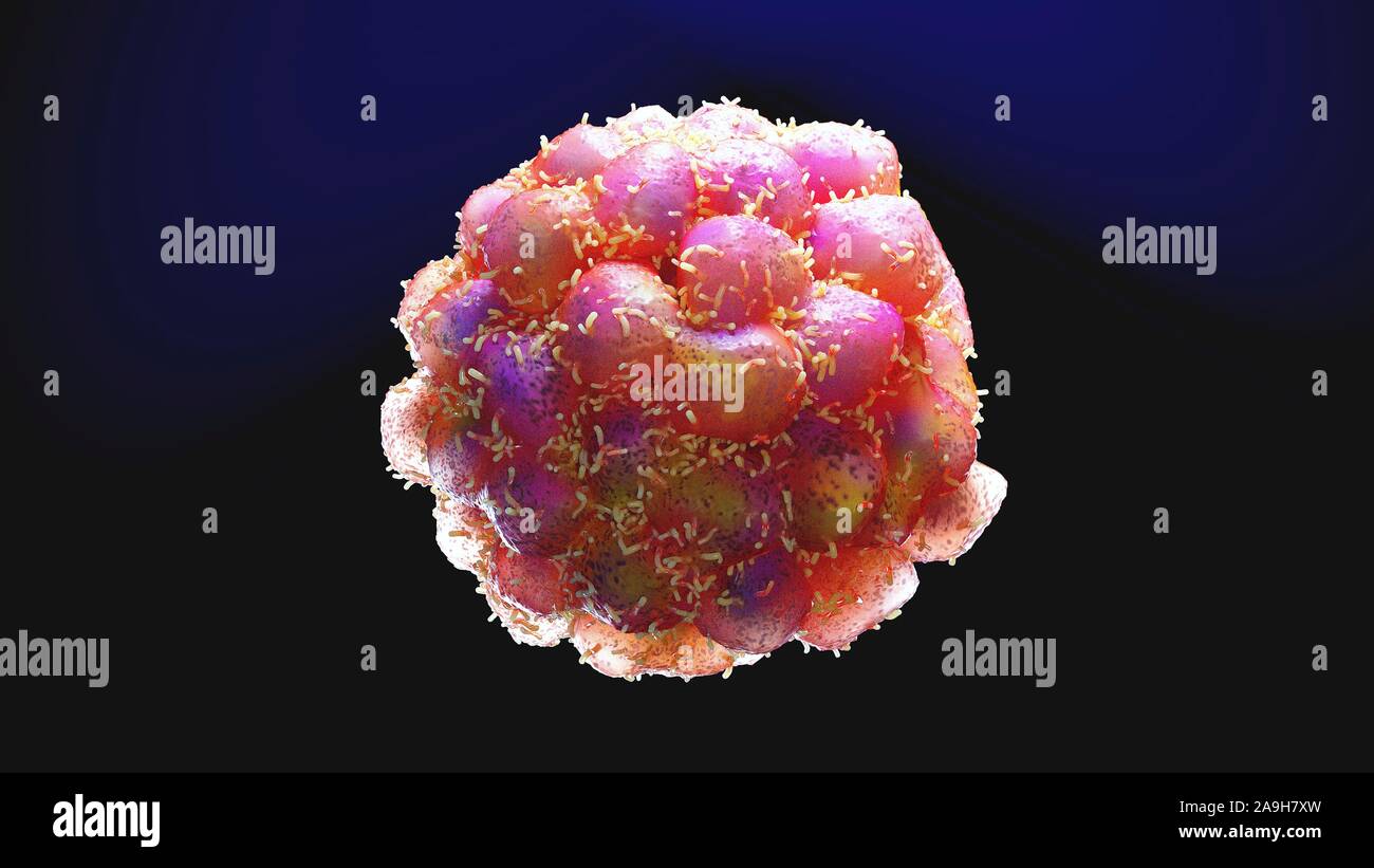 Cancer tumour hi-res stock photography and images - Alamy