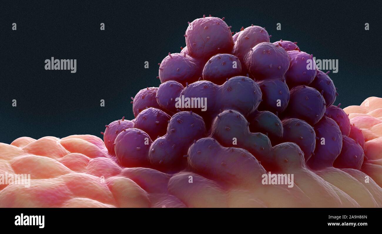 Tumour cell hi-res stock photography and images - Alamy