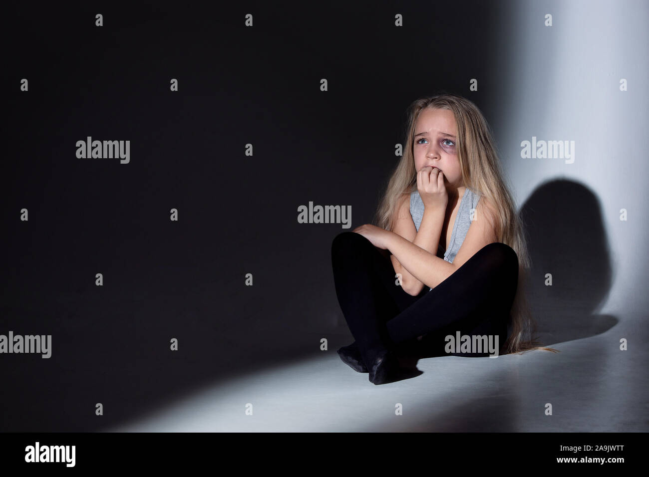 Sad and frightened little girl with bloodshot, bruised eyes crying ...