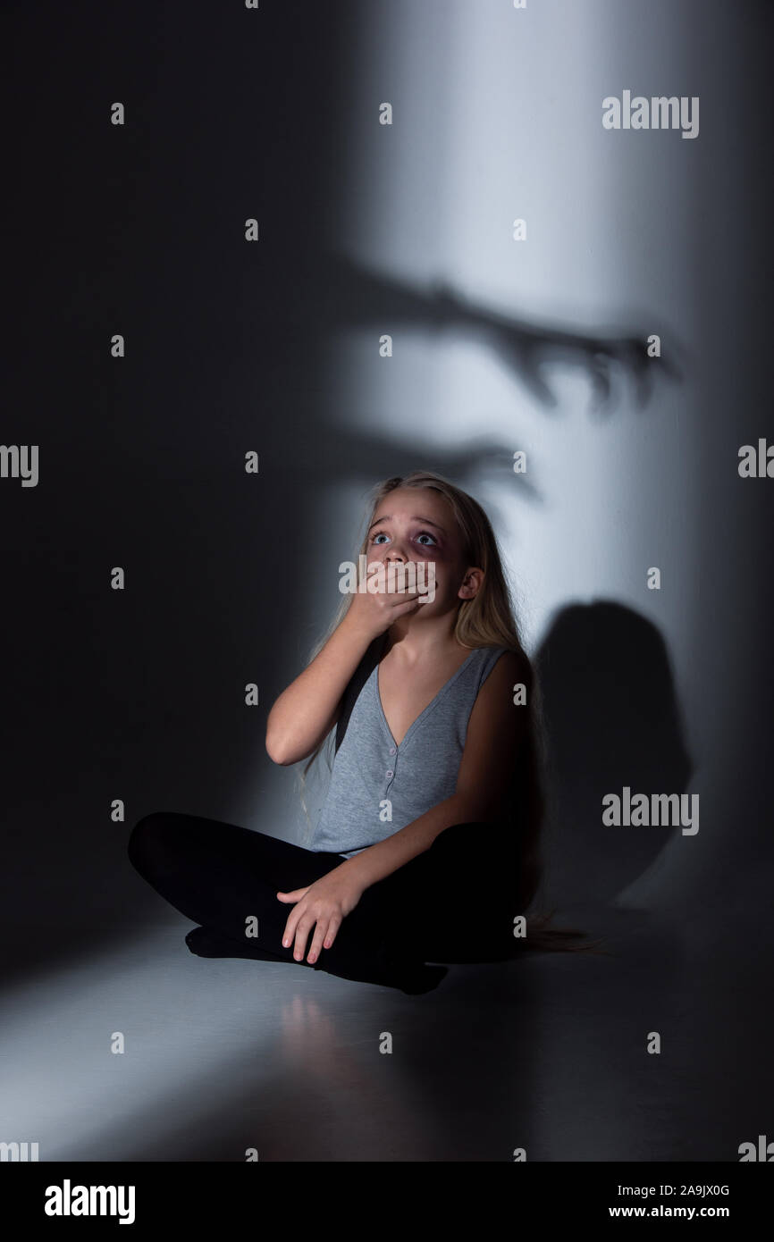 Sad and frightened little girl with bloodshot, bruised eyes crying ...