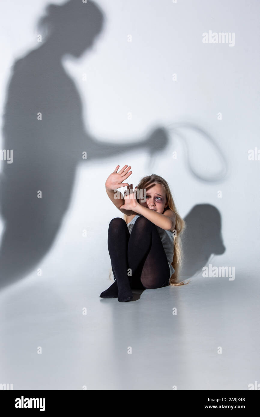 Sad and frightened little girl with bloodshot, bruised eyes crying ...