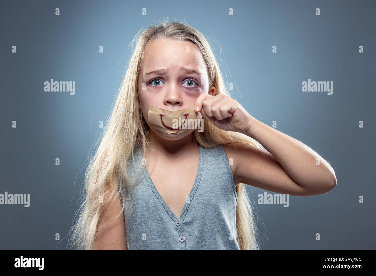 Sad and frightened little girl with bloodshot, bruised eyes and false ...