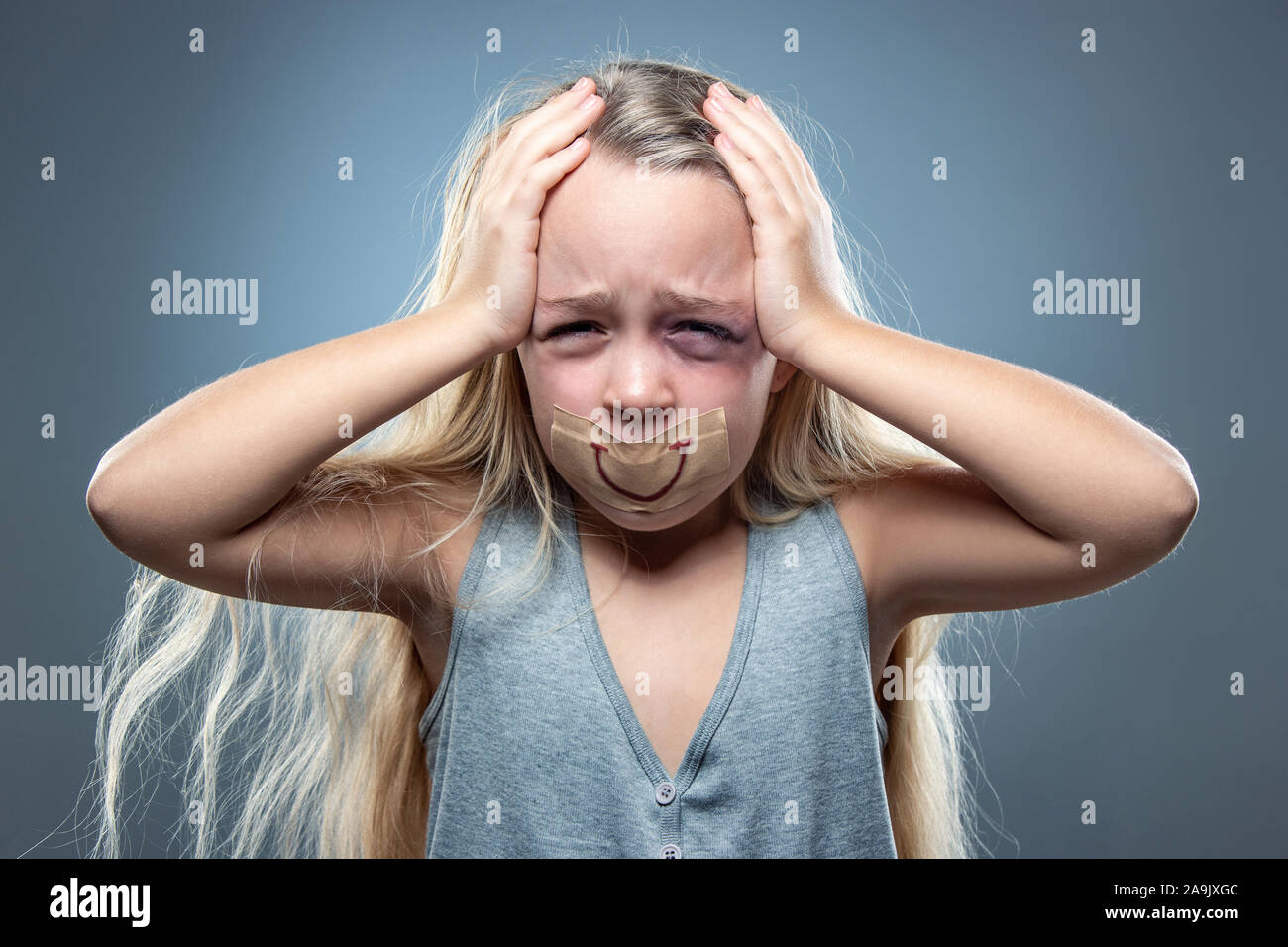 Sad and frightened little girl with bloodshot, bruised eyes and false ...