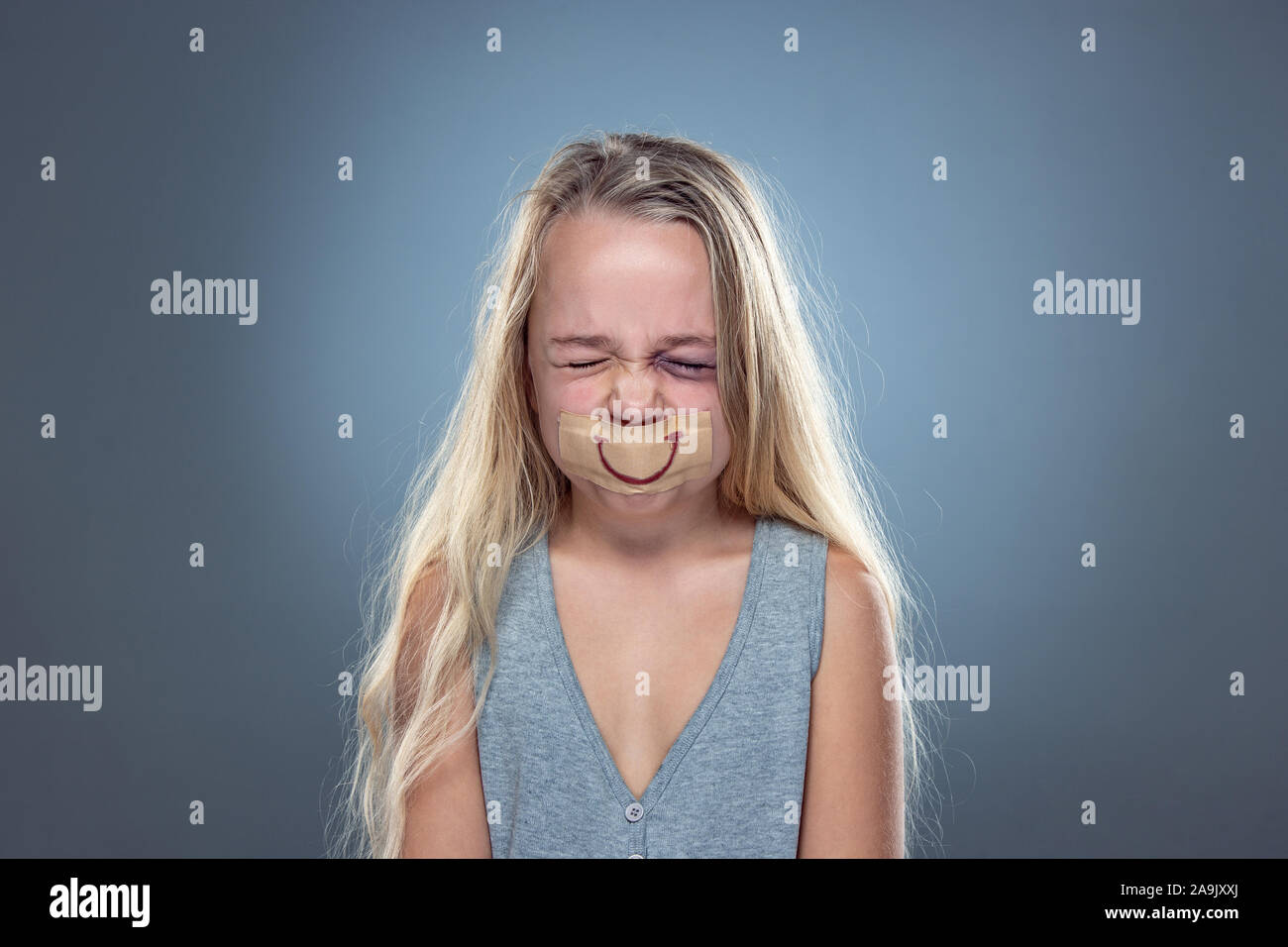 Sad and frightened little girl with bloodshot, bruised eyes and false ...