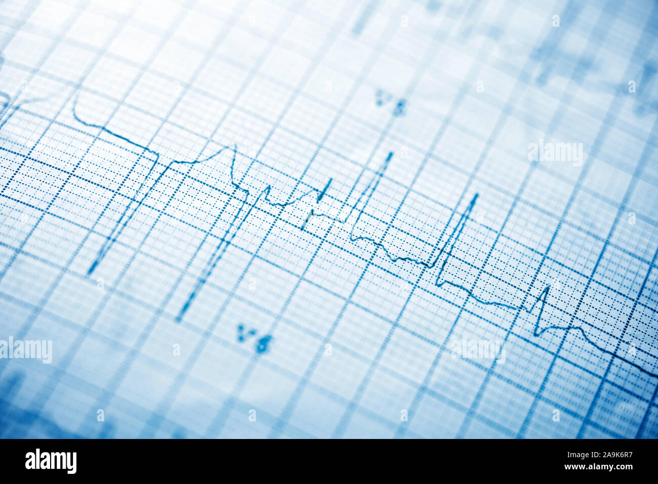 Close up of an electrocardiogram in paper form Stock Photo - Alamy