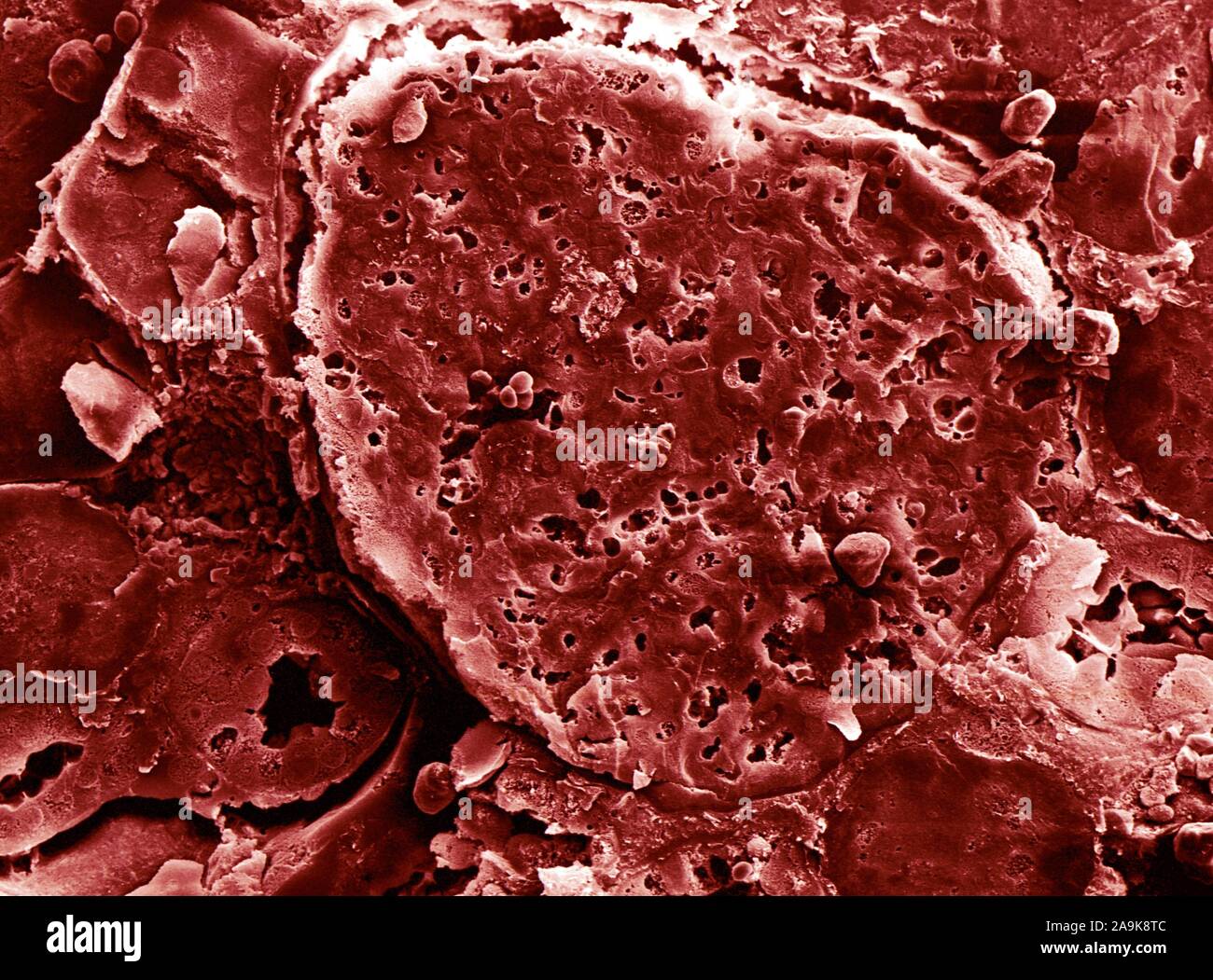 Human kidney with dna structure hi-res stock photography and images - Alamy