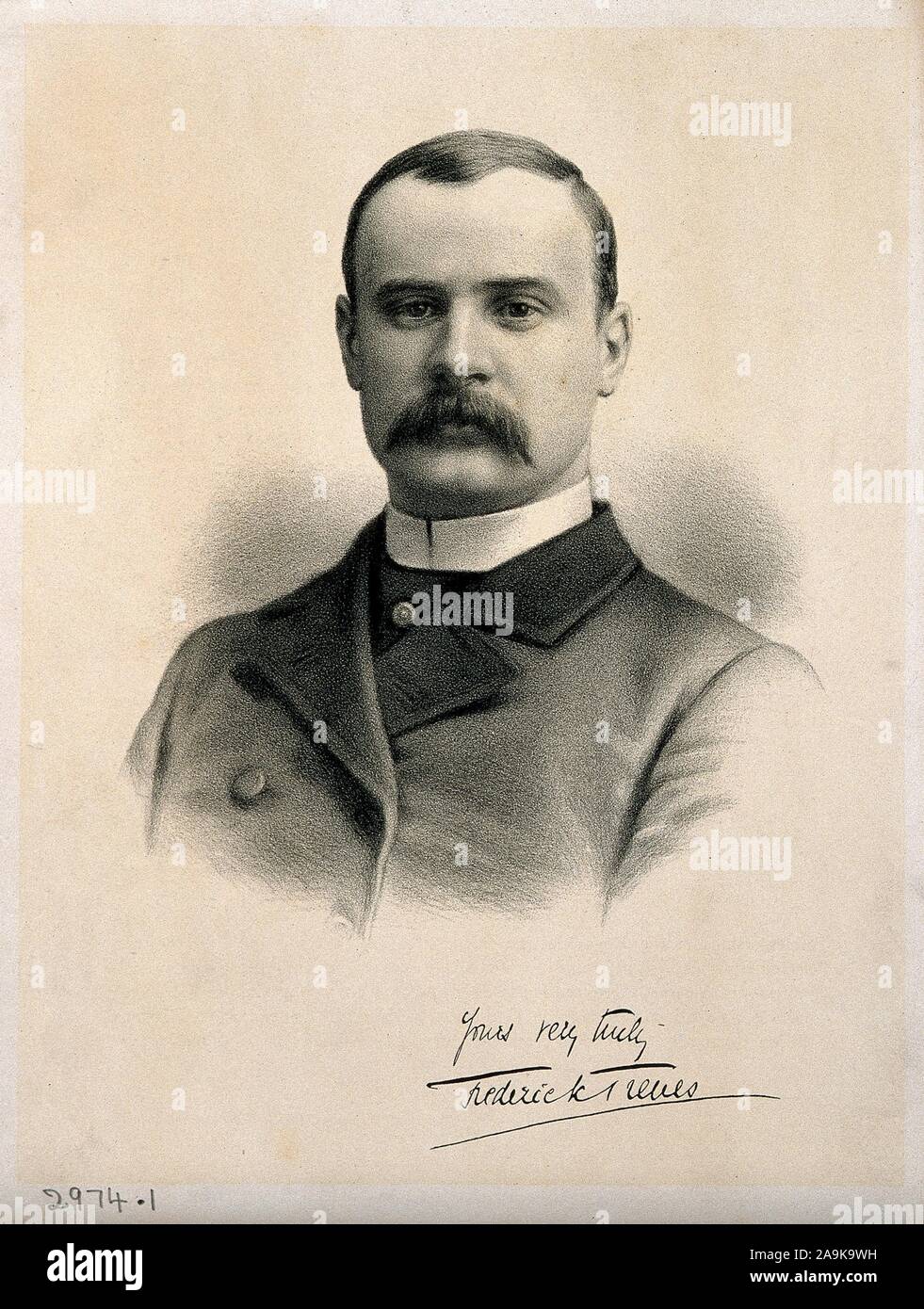 Frederick treves hi-res stock photography and images - Alamy