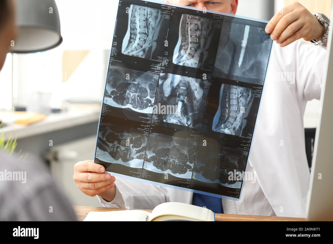 Radiologist showing x-ray Stock Photo - Alamy