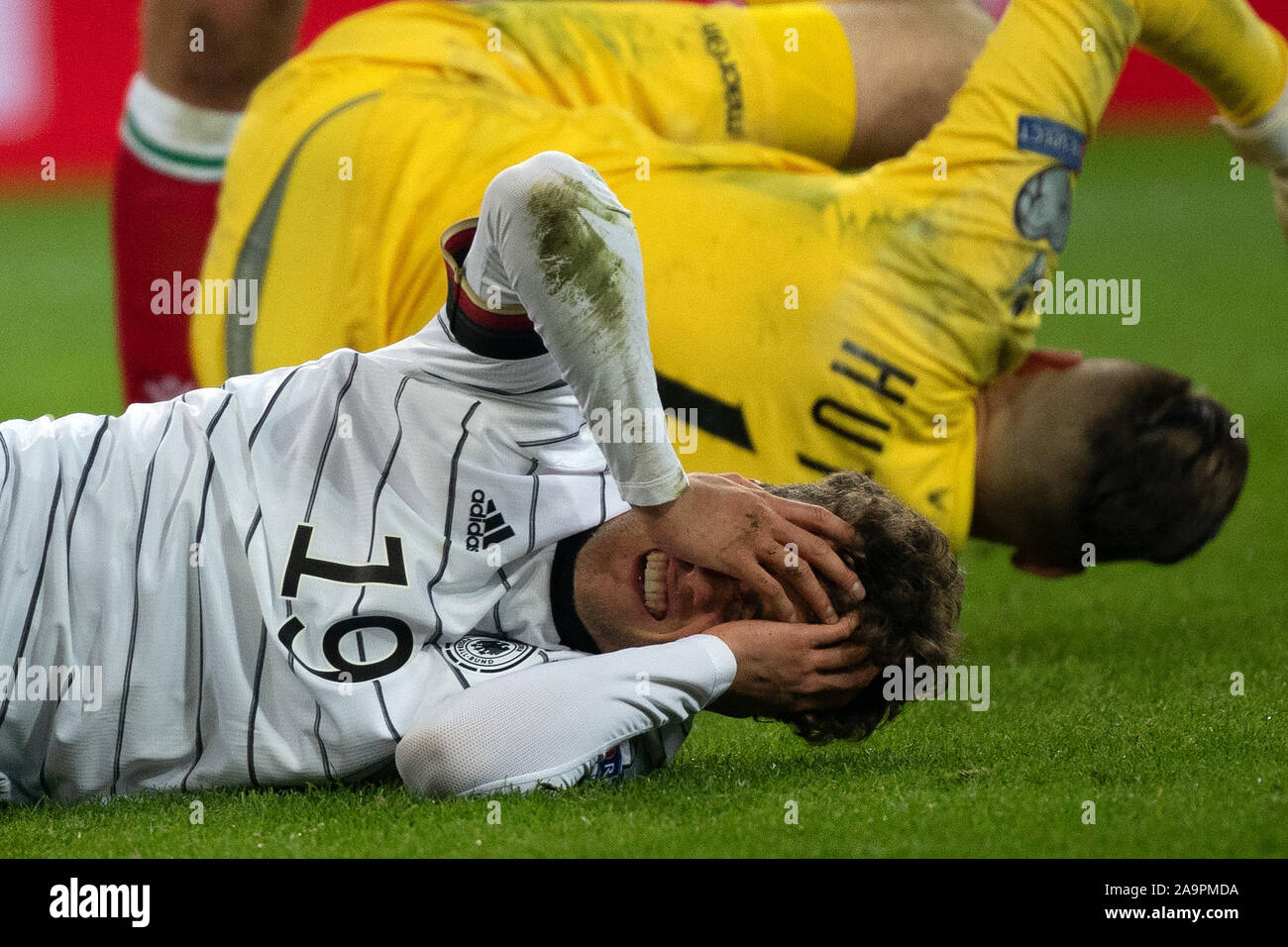 Soccer Compound Fractures