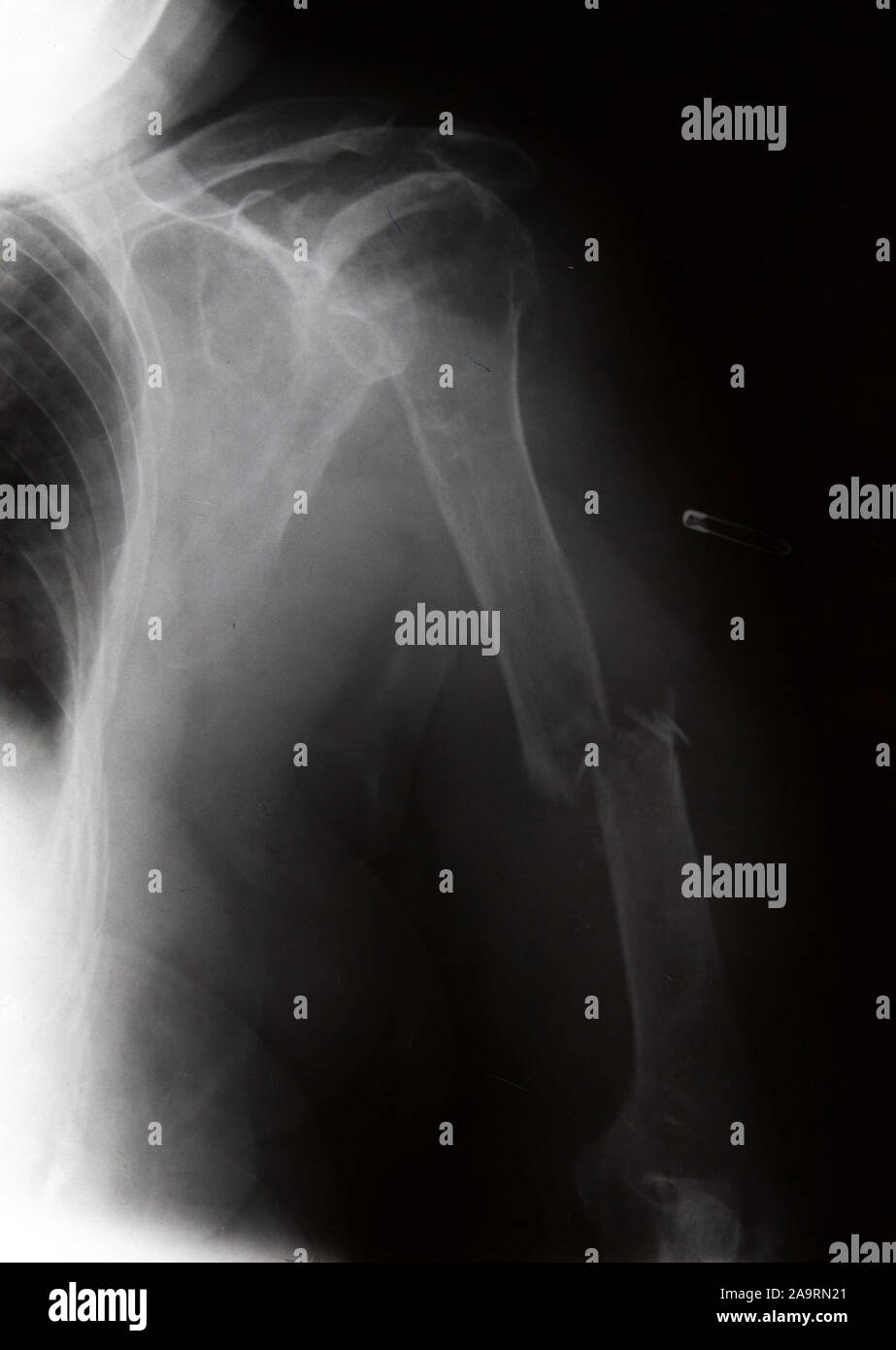 Humorous skeleton hi-res stock photography and images - Alamy