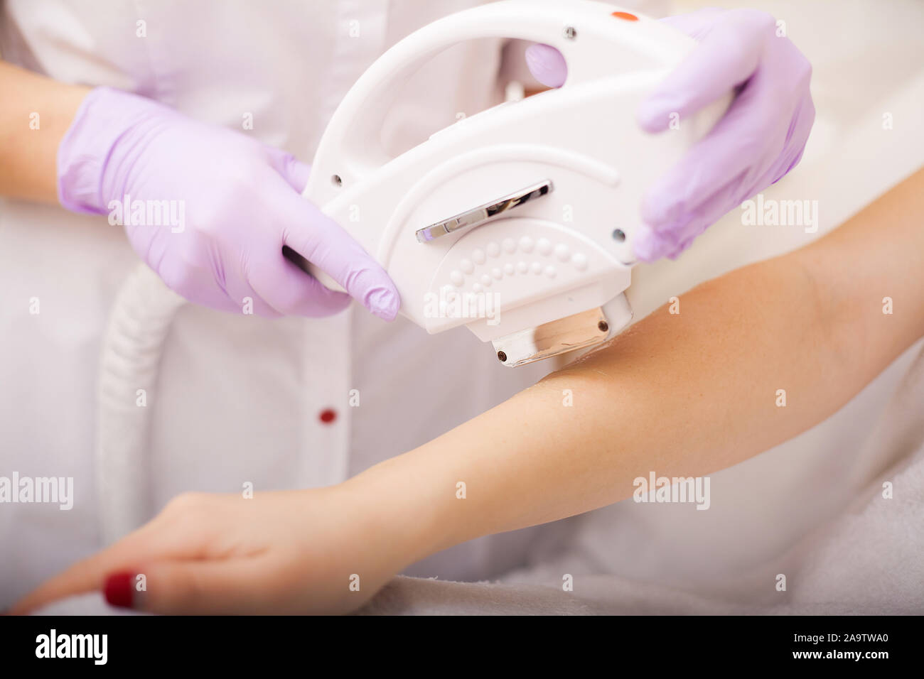 Skin care. Hands Laser epilation and cosmetology. Hair removal ...