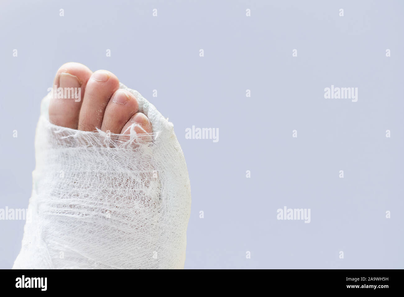 Broken Toe Plaster High Resolution Stock Photography and Images - Alamy