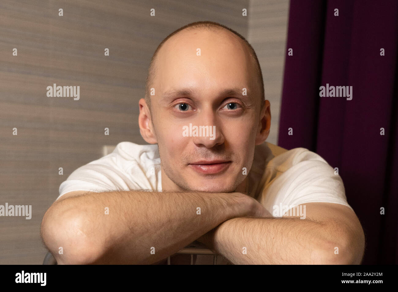 A 30-year-old man without hair laid his chin in his hands and looks at ...