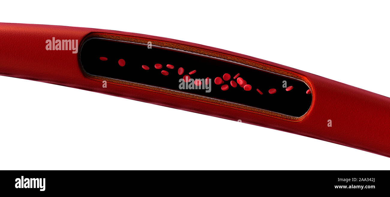 blood vessels, artery shown with a cut out section, High quality ...