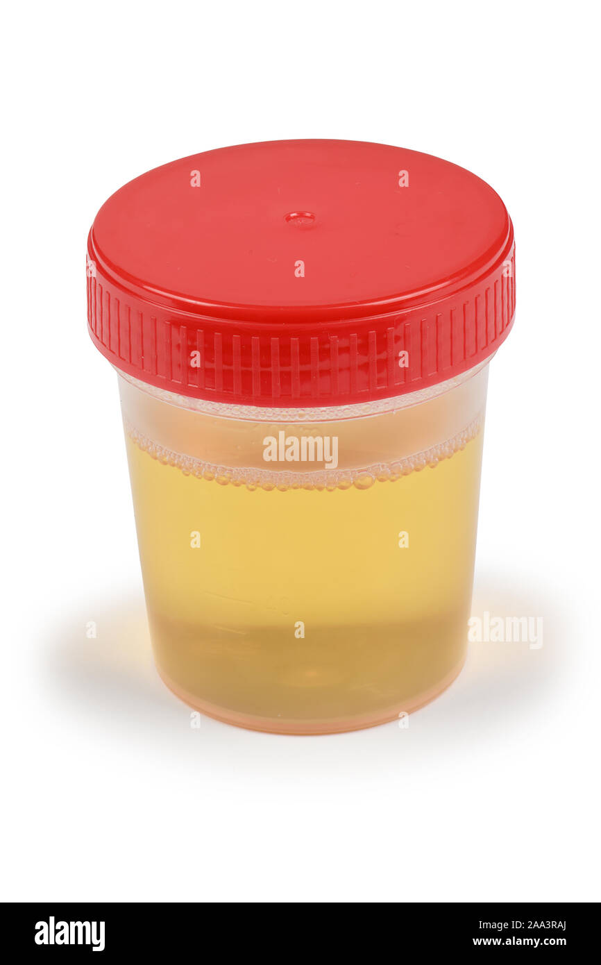 Urine sample in container. High resolution photo. With clipping path ...