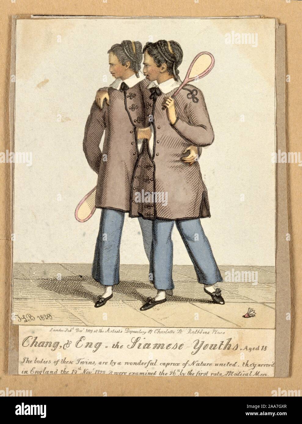 Siamese twins chang and eng hi-res stock photography and images - Alamy