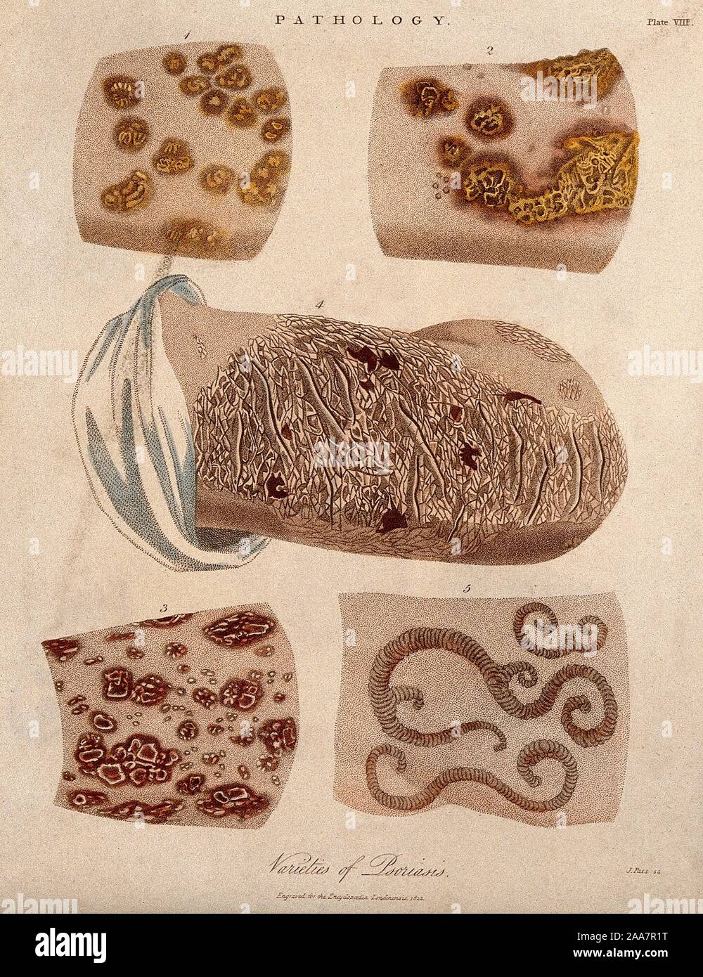Anatomy body types hi-res stock photography and images - Alamy