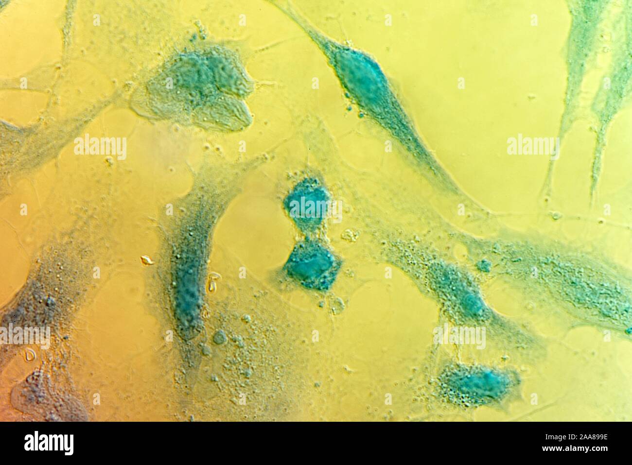 HeLa cervical cancer cells, stained with Coomassie blue, under ...