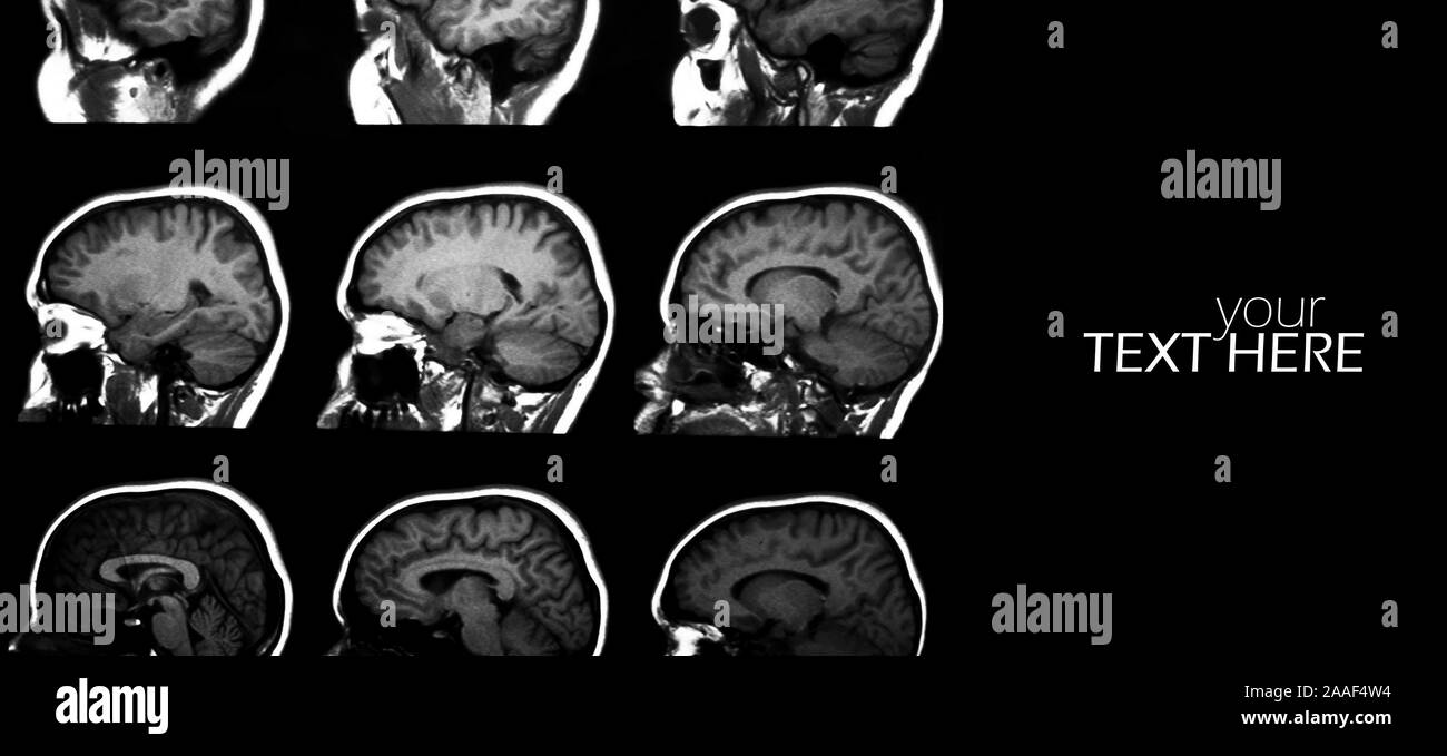 Mri Scanner Black and White Stock Photos & Images - Alamy