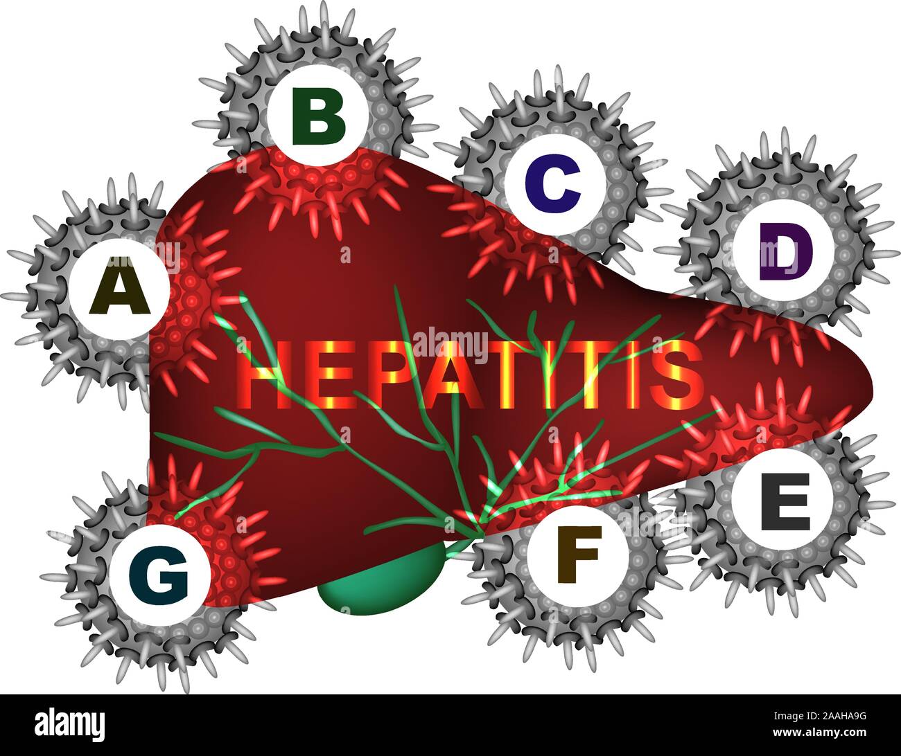 Types of viral hepatitis. Hepatitis A, B, C, D, E, F, G. World Hepatitis Day. Infographics ...