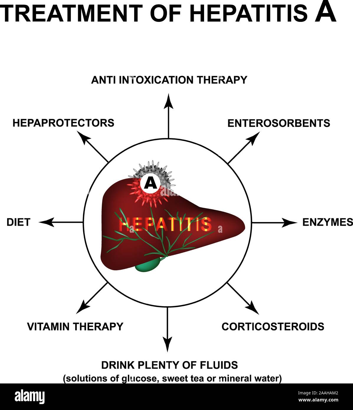 Treatment of hepatitis A. World Hepatitis Day. Infographics. Vector ...