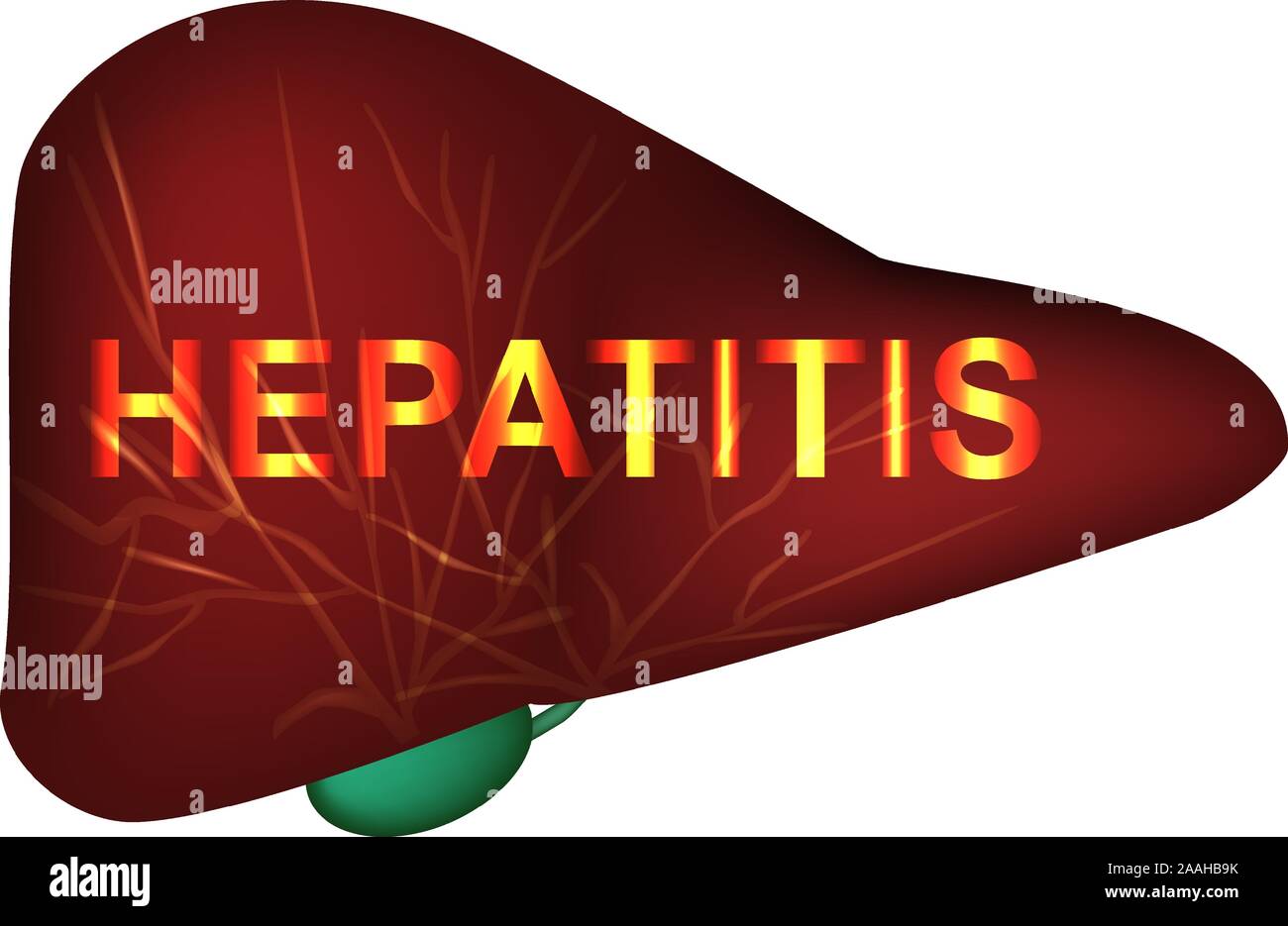 Types of hepatitis Stock Vector Images - Alamy